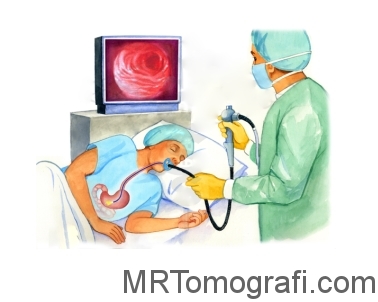 Gastroskopi - Nedir, Nasıl Yapılır, Öncesi ve Sonrası Hazırlıklar